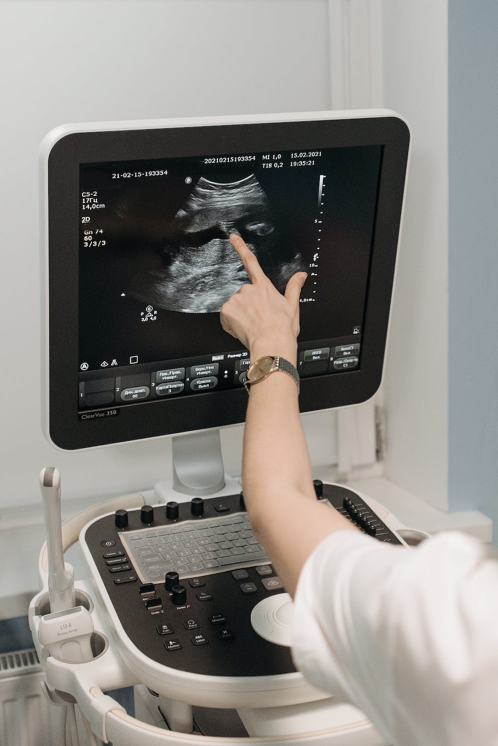 Fertility Scans Dublin | IVF & Ovulation Monitoring | Ultrasound ...